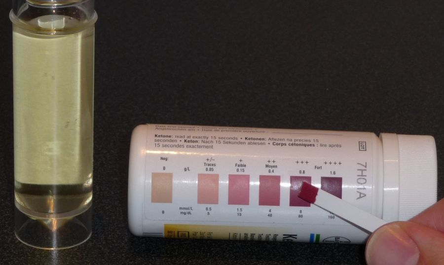 Cetose: Dieta Cetogênica, Sintomas E Como Entrar Em Cetose